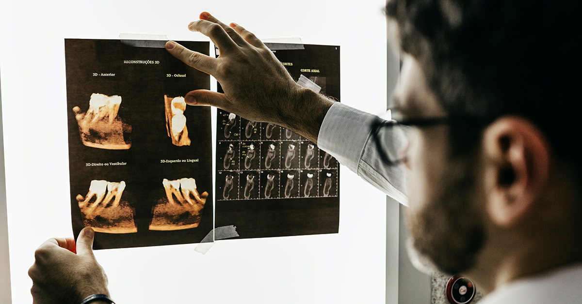 The What, When, and How of Requesting Your Dental Records