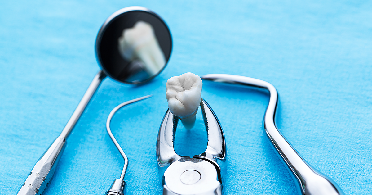 When and Why a Tooth Extraction is Necessary (and What to Expect During ...